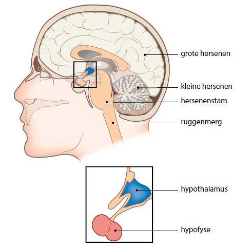 Gynaecomastie | Prelum Academy