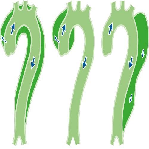 D-dimeer | Prelum Academy